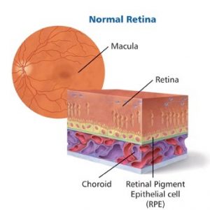 What is Age-Related Macular Degeneration? | Macular Disease Foundation ...