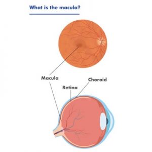 About Macular Disease | Macular Disease Foundation Australia